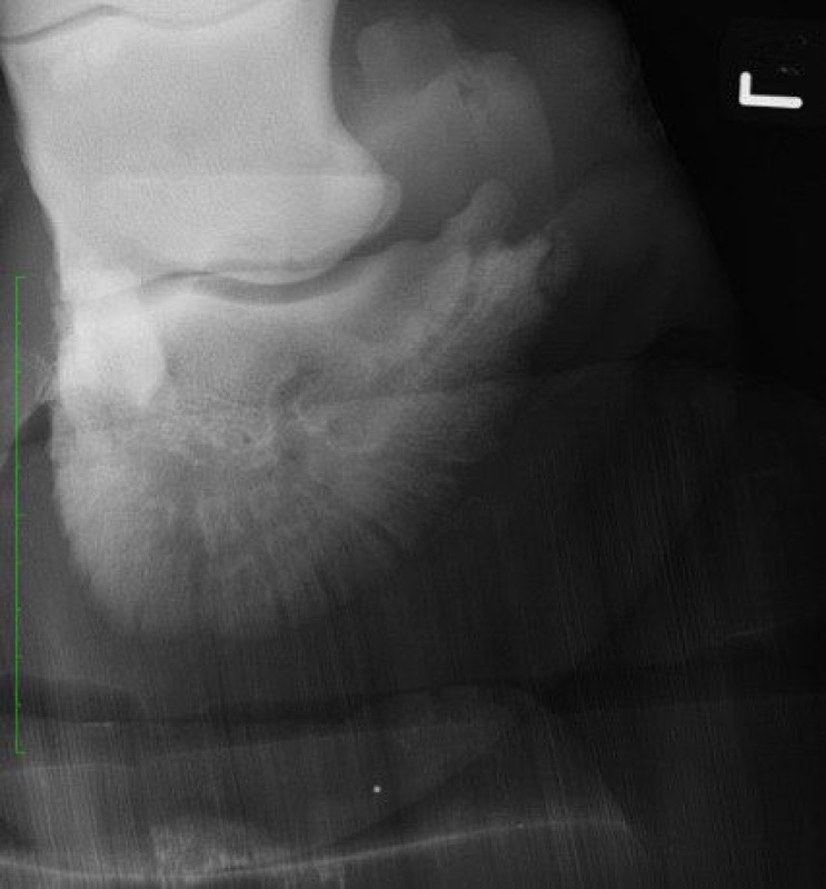 Cas Un cas de fracture de P3 chez un cheval | VetPixel